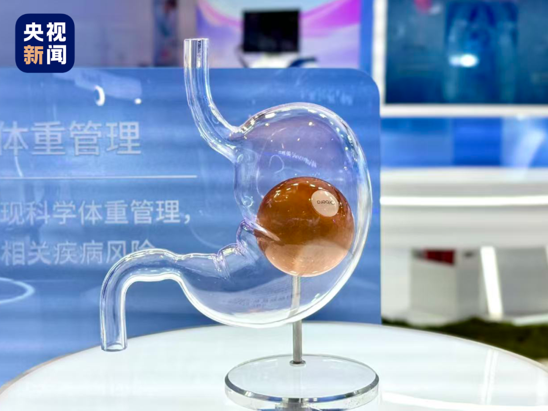 减肥、降脂、缓解偏头痛、预防带状疱疹……多款健康“黑科技”来帮你！